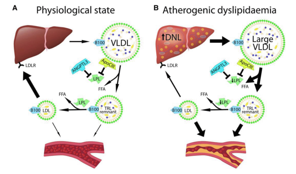 Systemic manifestations of systemic metabolic disorder - EAS